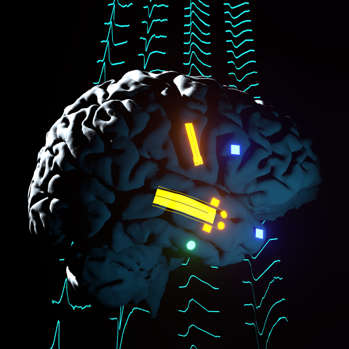 Neurotechnology - CashLab - MGH/Harvard